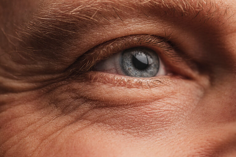 Dacrorhinocystostomy (DCR) | Alaska Facial Plastic Surgery and ENT